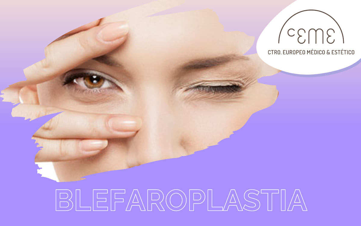 Blefaroplastia o cirugía de párpados precio - Ceme